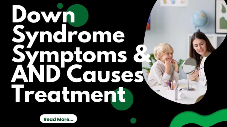 Down Syndrome Symptoms Causes treatment